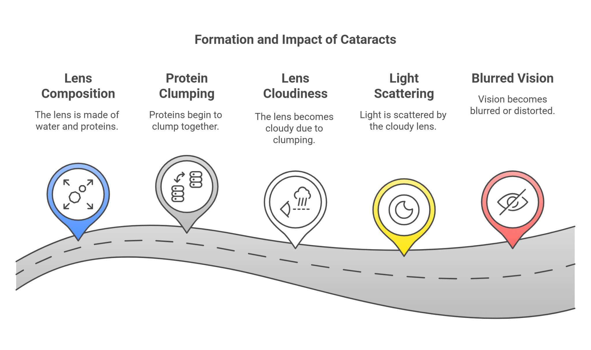 What Is the Main Cause of Cataract? Understanding Risk Factors and Prevention - Indira Gandhi ...