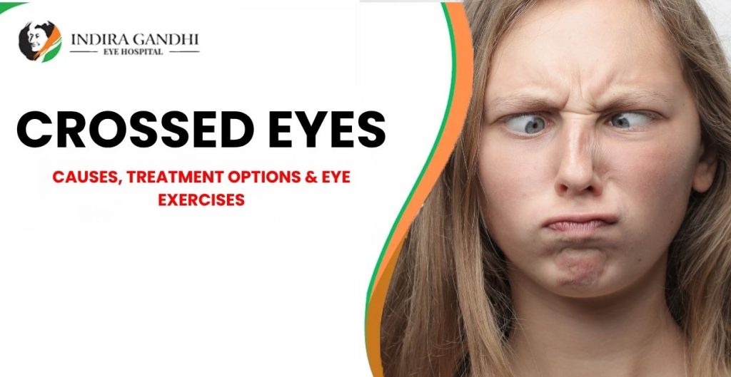 Crossed Eyes: Causes, Treatment Options & Eye Exercises - Indira Gandhi ...