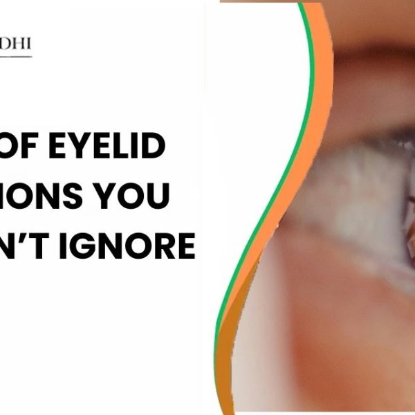 How to Reduce Eye Number Naturally: Effective Tips and Home Remedies ...